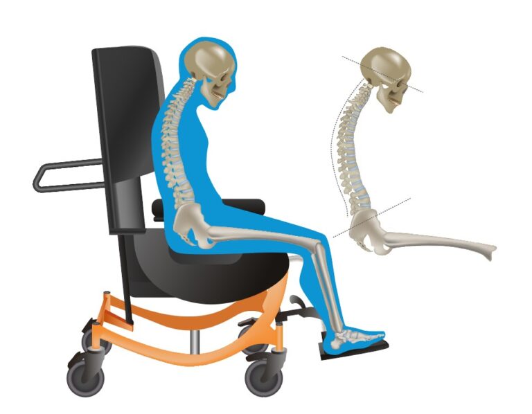 Abnormal Postures & Wheelchair Seating | Broda