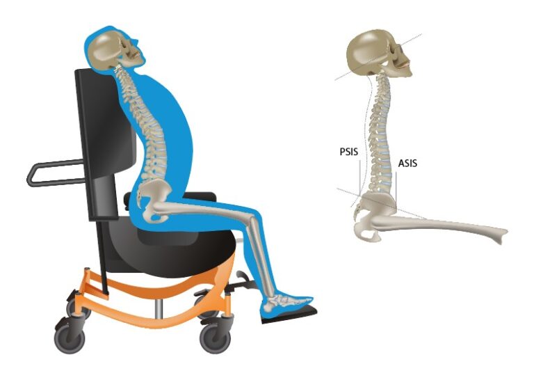 Abnormal Postures & Wheelchair Seating | Broda