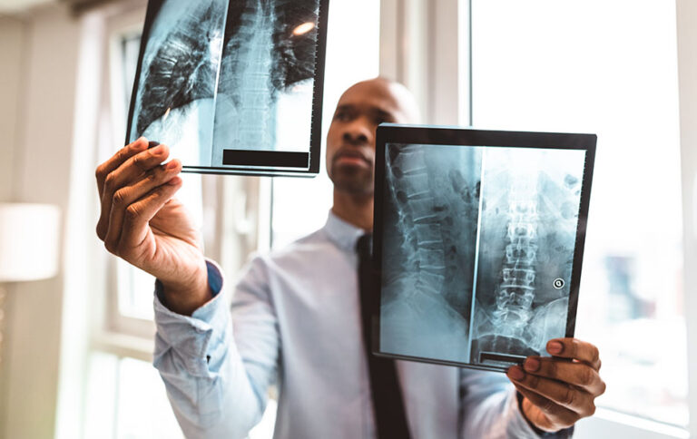 Wheelchair Disabilities List: Individualized Mobility Needs